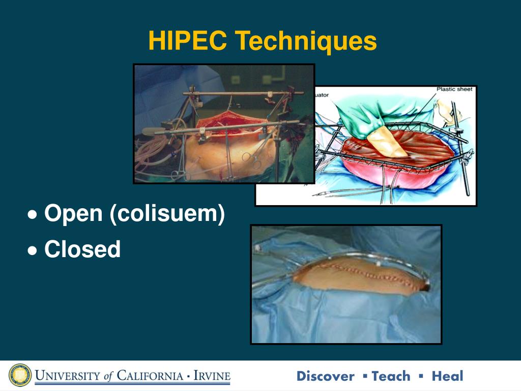 PPT - Robert E. Bristow, MD, MBA Professor and Director Division of ...