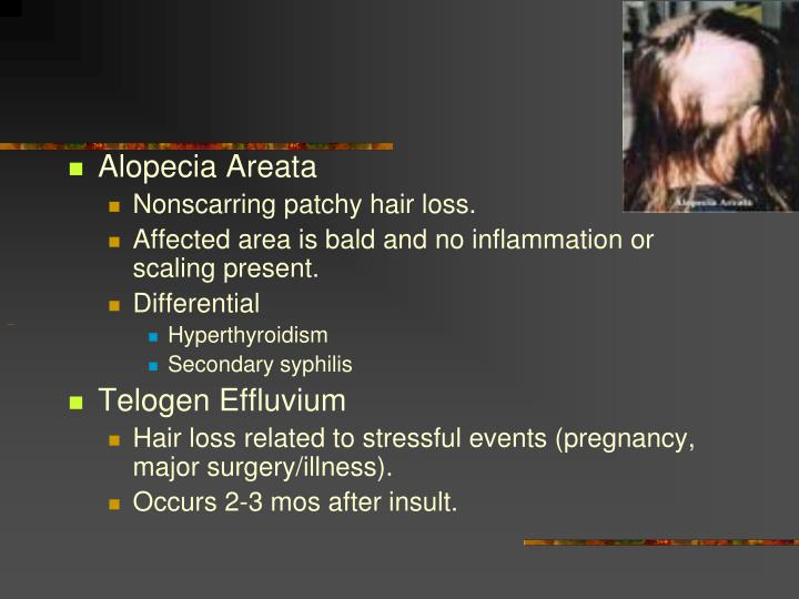 PPT - Disorders of the face and scalp PowerPoint Presentation - ID:1088756