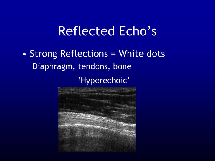 PPT - Ultrasound Physics PowerPoint Presentation - ID:1089509