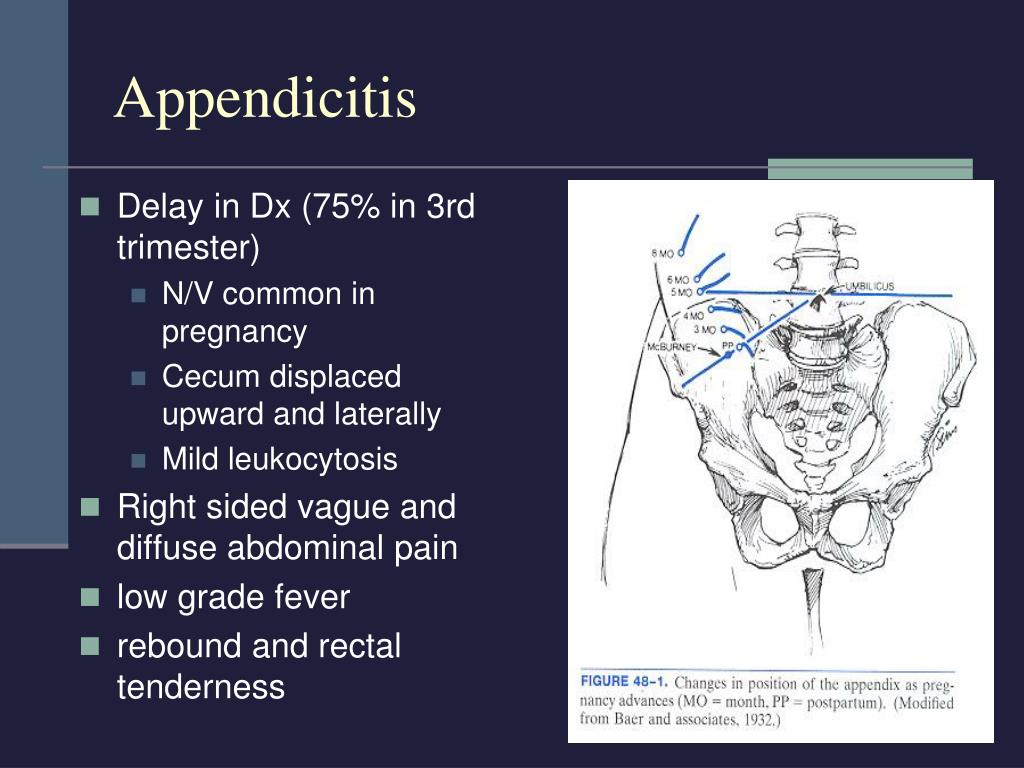PPT - Medical Complications of Pregnancy PowerPoint Presentation, free ...