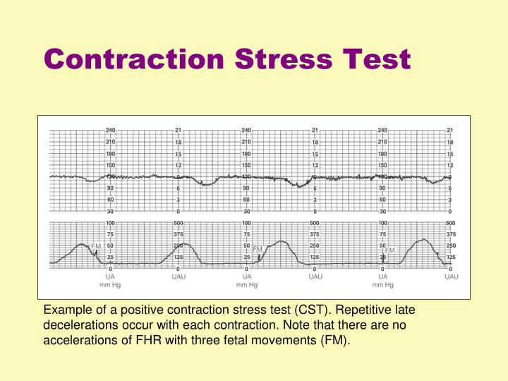 PPT - Fetal Well-being and Electronic Fetal Monitoring PowerPoint ...