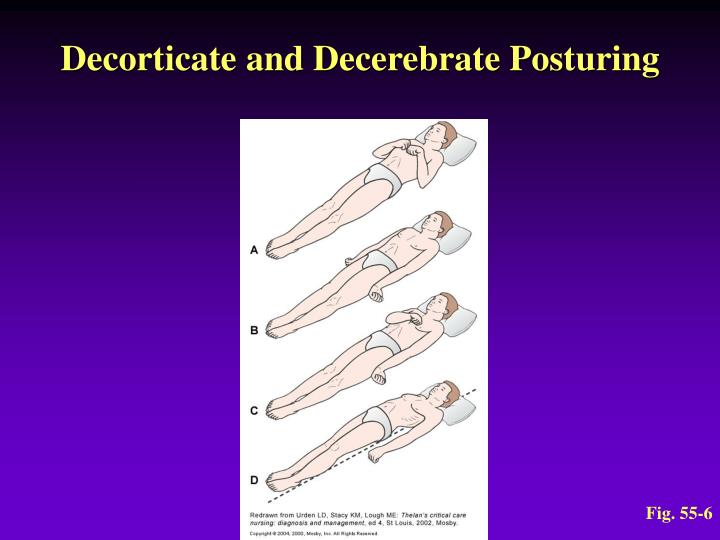 PPT - REPONSE OF BRAIN TISSUE TO TRAUMA PowerPoint Presentation - ID ...