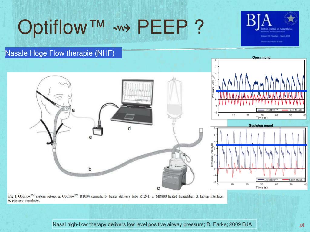 PPT - Gerard Burggraaf IC-verpleegkundige Ventilation Practitioner ...