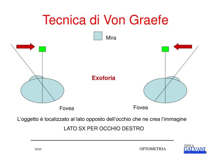 PPT - Tecniche di misura dell’eteroforie PowerPoint Presentation - ID ...