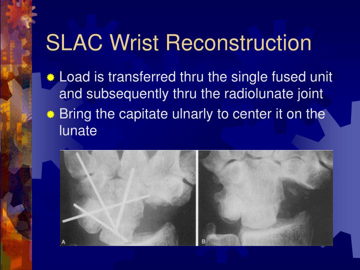 PPT - SLAC Wrist PowerPoint Presentation - ID:1099204