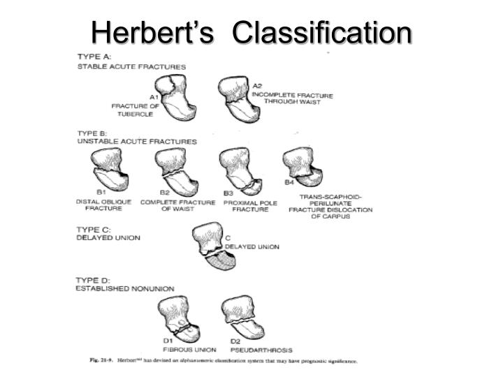 PPT - Normal wrist joint PowerPoint Presentation - ID:1102536