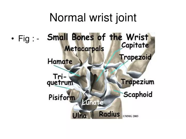 PPT - Normal wrist joint PowerPoint Presentation, free download - ID ...