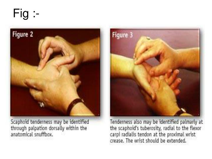 PPT - Normal wrist joint PowerPoint Presentation - ID:1102536