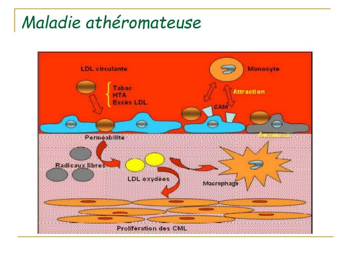 PPT - Maladie athéromateuse PowerPoint Presentation - ID:1104535