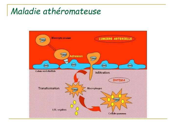 PPT - Maladie athéromateuse PowerPoint Presentation - ID:1104535