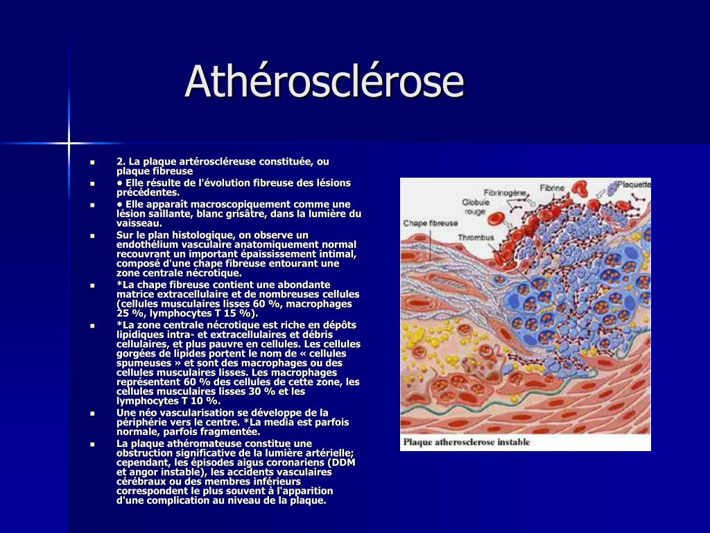 PPT - Épidémiologie et prévention des maladies cardio-vasculaires ...