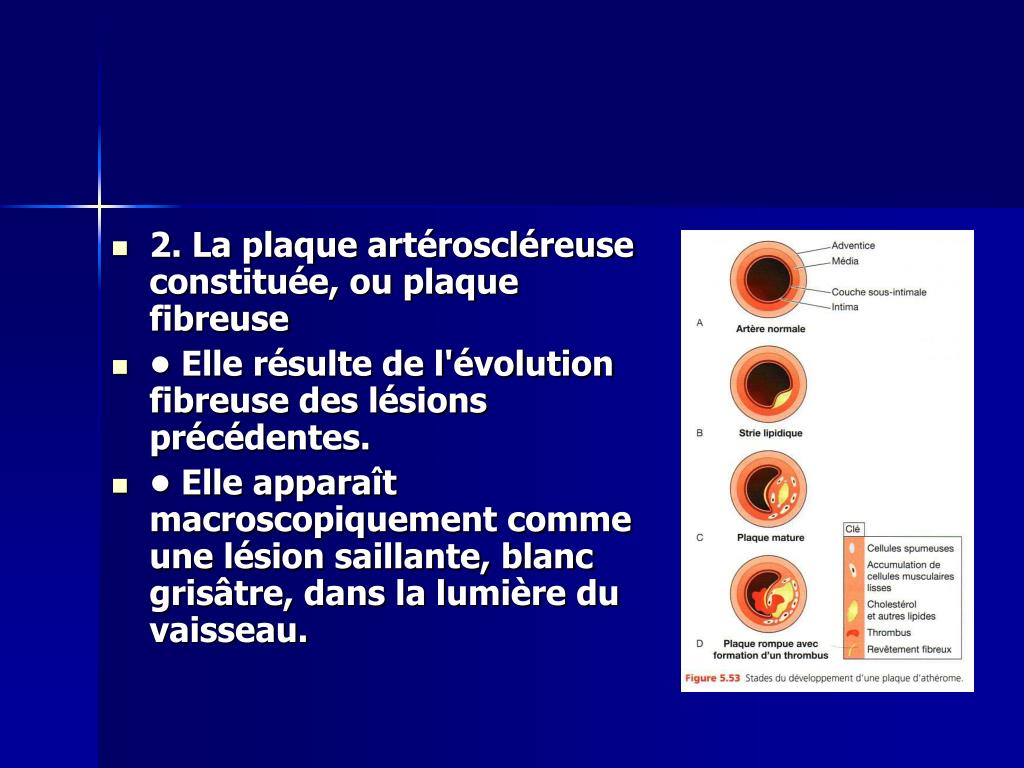 PPT - Épidémiologie et prévention des maladies cardio-vasculaires ...