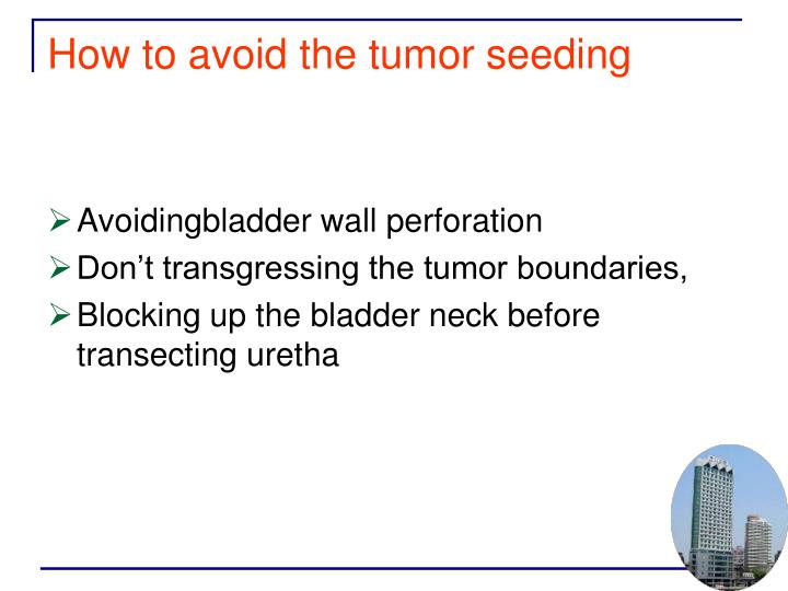 PPT - Laparoscopic Radical Cystectomy with Orthotopic Ileal Neobladder ...
