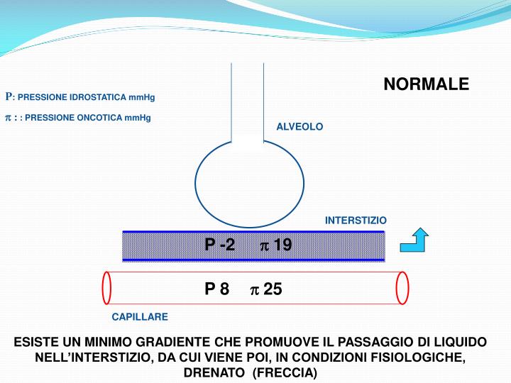 PPT - EDEMA POLMONARE PowerPoint Presentation - ID:1110160