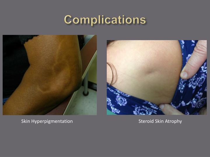 PPT - Arthrocentesis and Joint Injection for the Internist PowerPoint ...