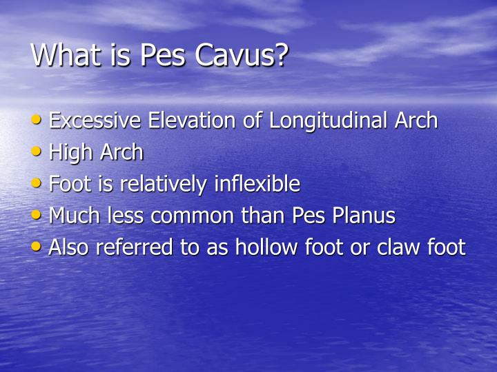 PPT - Pes Cavus PowerPoint Presentation - ID:1114892