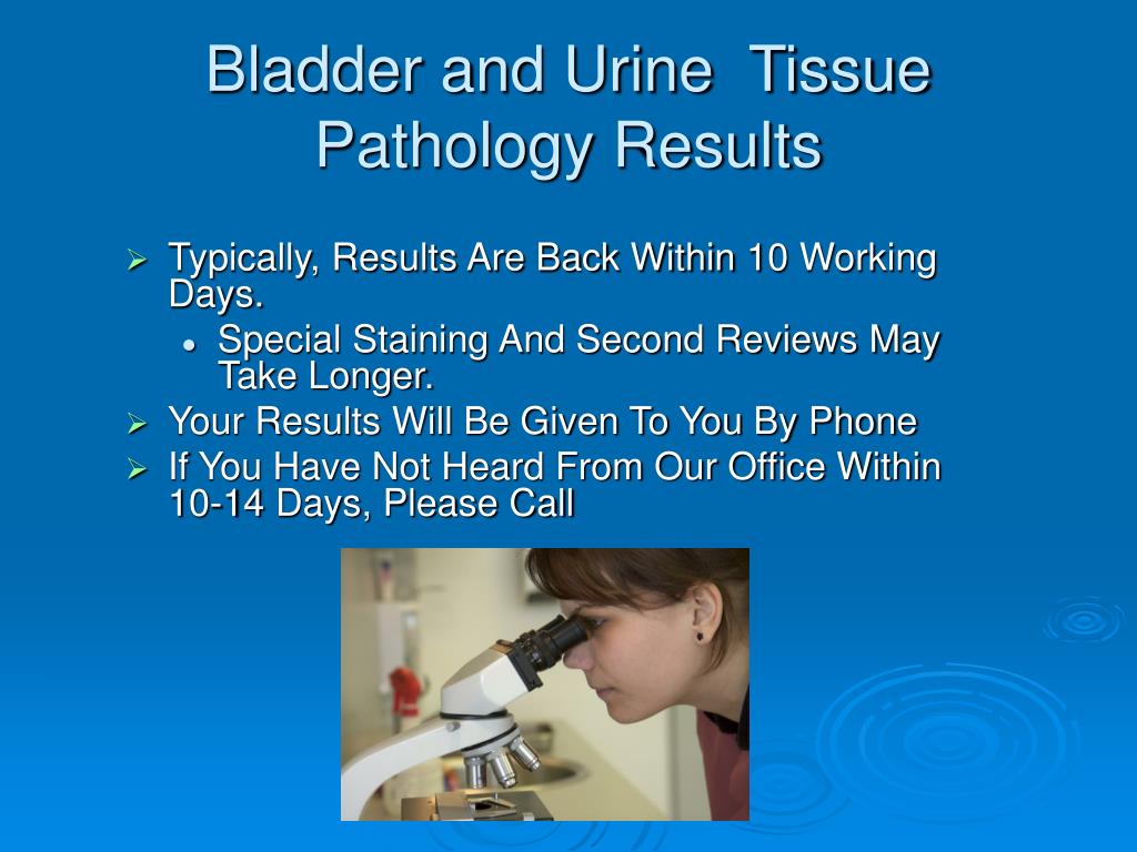 PPT - Cystoscopy Cystoscopy and Stent Removal Cystoscopy and Biopsy ...