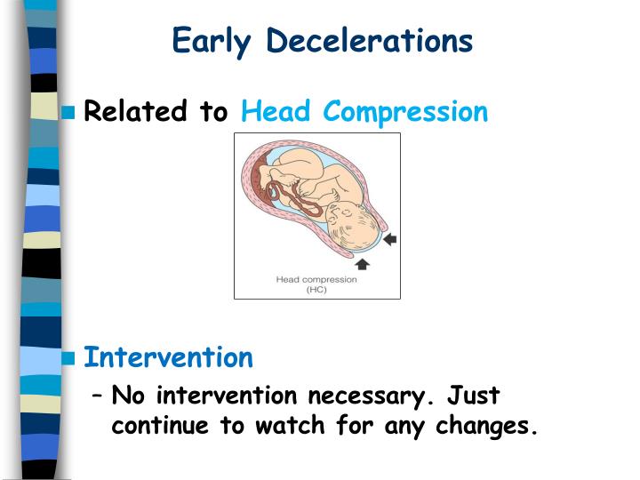 PPT - Fetal Monitoring PowerPoint Presentation - ID:1115826