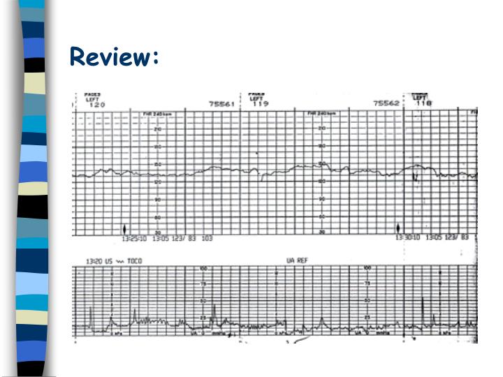 PPT - Fetal Monitoring PowerPoint Presentation - ID:1115826