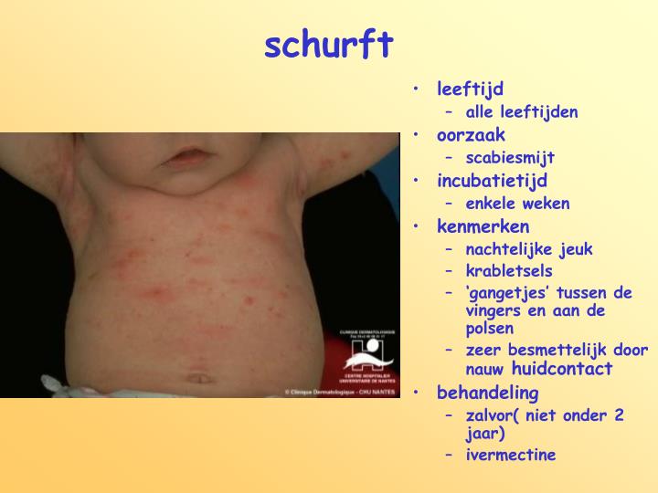 PPT - de huid van onze spruit Dr. Hilde De Veylder (Huidarts ...