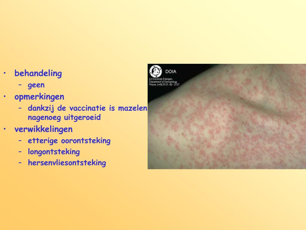 PPT - de huid van onze spruit Dr. Hilde De Veylder (Huidarts ...