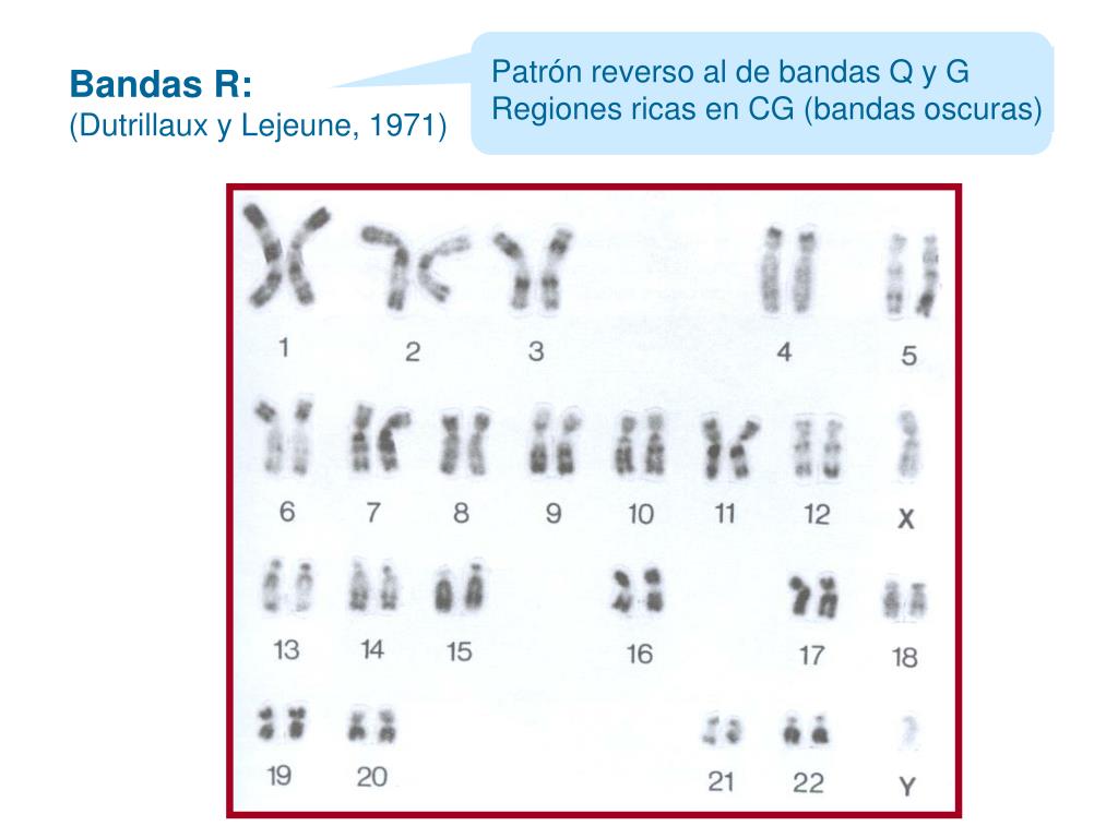 PPT - Citogenética Estudio del cariotipo humano. Descripción y ...
