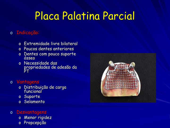 PPT - Conectores maiores PowerPoint Presentation - ID:1119578