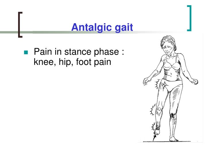 PPT - Gait & Gait Aids PowerPoint Presentation - ID:1120864