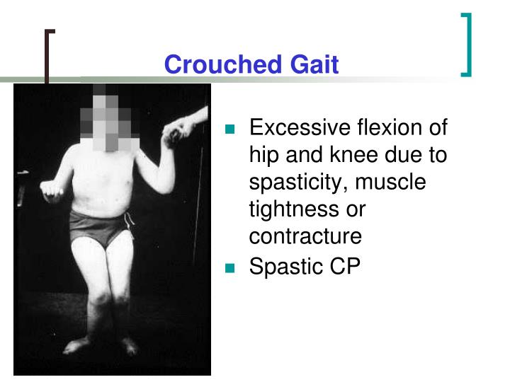 PPT - Gait & Gait Aids PowerPoint Presentation - ID:1120864