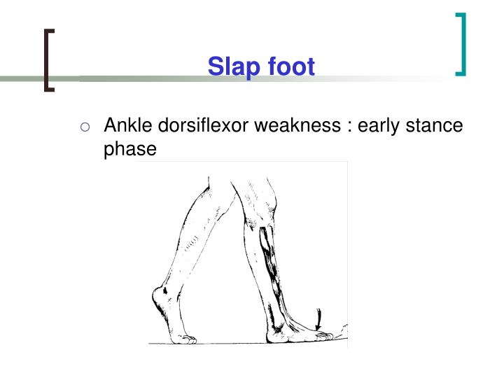 PPT - Gait & Gait Aids PowerPoint Presentation - ID:1120864