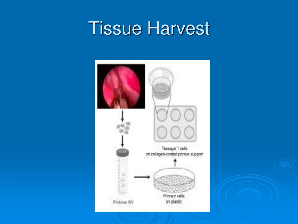 PPT - Eotaxin: a Potential Target for Therapy in Chronic Rhinosinusitis ...