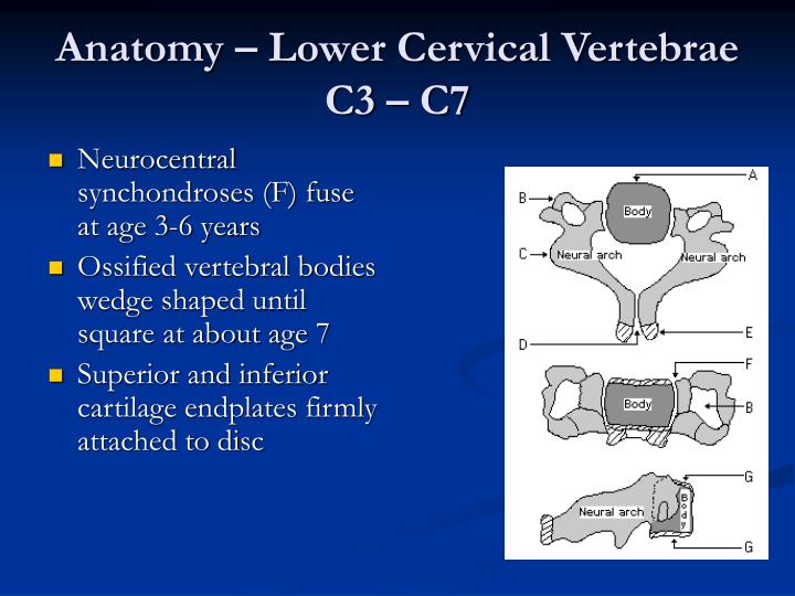 PPT - Pediatric C-Spine Trauma: Clearing the C-Spine PowerPoint ...