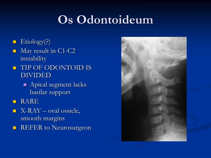 PPT - Pediatric C-Spine Trauma: Clearing the C-Spine PowerPoint ...