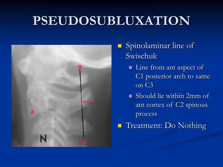 PPT - Pediatric C-Spine Trauma: Clearing the C-Spine PowerPoint ...