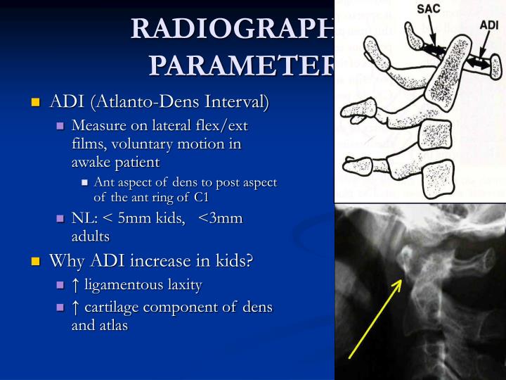 PPT - Pediatric C-Spine Trauma: Clearing the C-Spine PowerPoint ...
