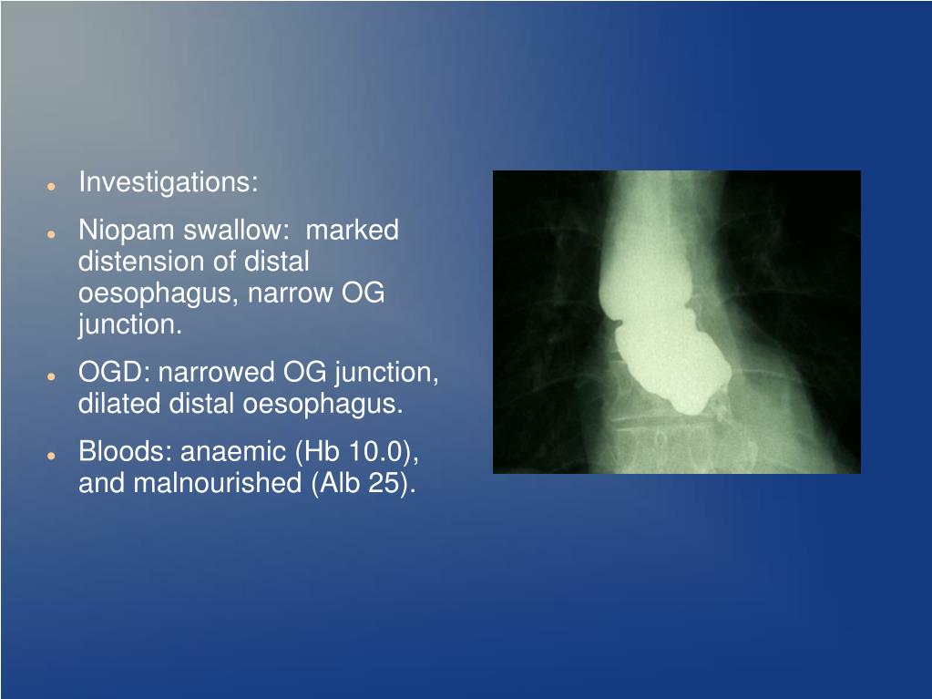 PPT - Colonic interposition for benign oesophageal disease. PowerPoint ...