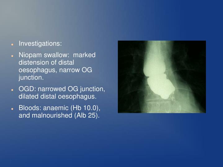 PPT - Colonic interposition for benign oesophageal disease. PowerPoint ...