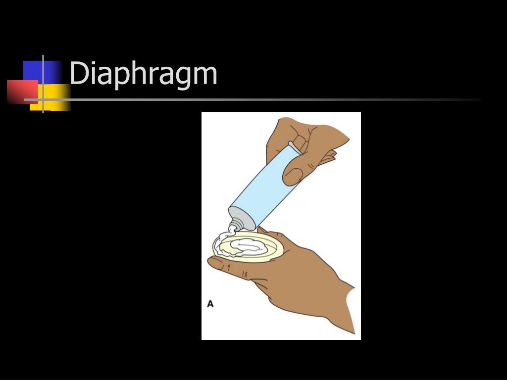 PPT - Comprehensive Guide to Family Planning and Contraception Options ...