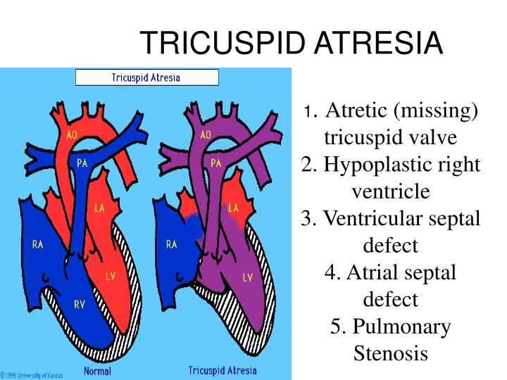 PPT - More Pedia Cardio slides PowerPoint Presentation - ID:1130789
