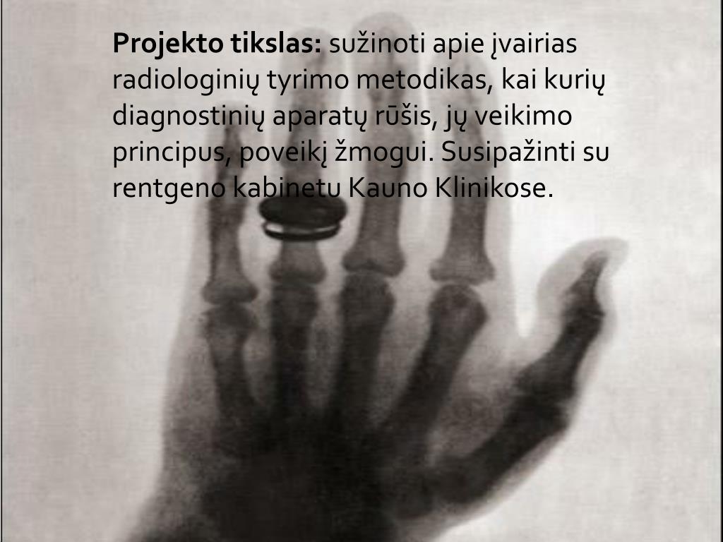 PPT - Radiologija Kauno klinikose PowerPoint Presentation, free ...