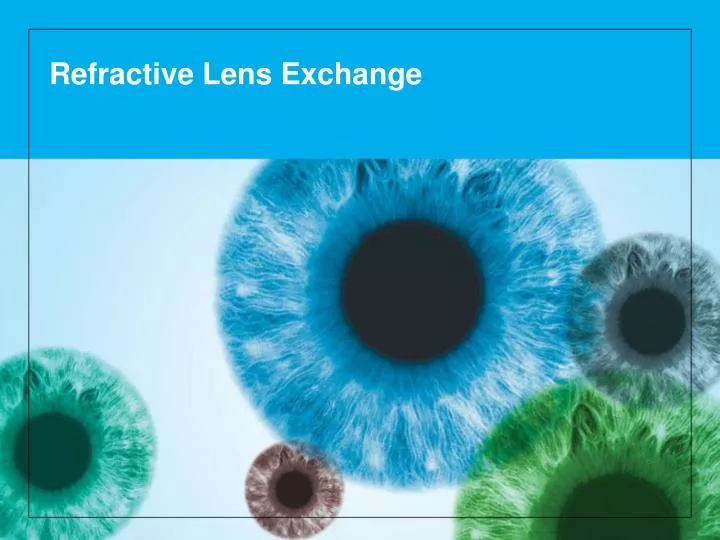 PPT - Refractive Lens Exchange PowerPoint Presentation, free download ...