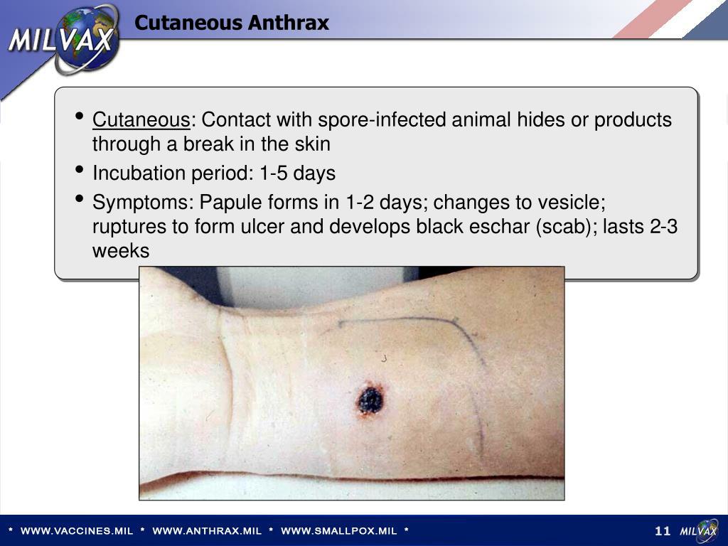 PPT - Anthrax Vaccine Policy and Safety Briefing PowerPoint ...