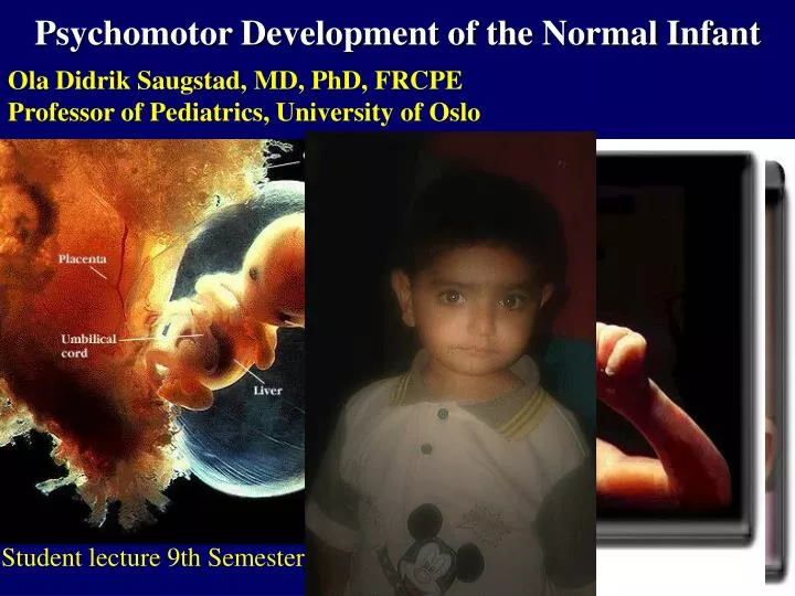 PPT - Psychomotor Development of the Normal Infant PowerPoint ...