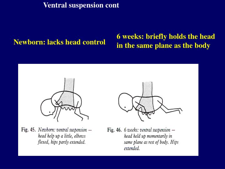 PPT - Psychomotor Development of the Normal Infant PowerPoint ...