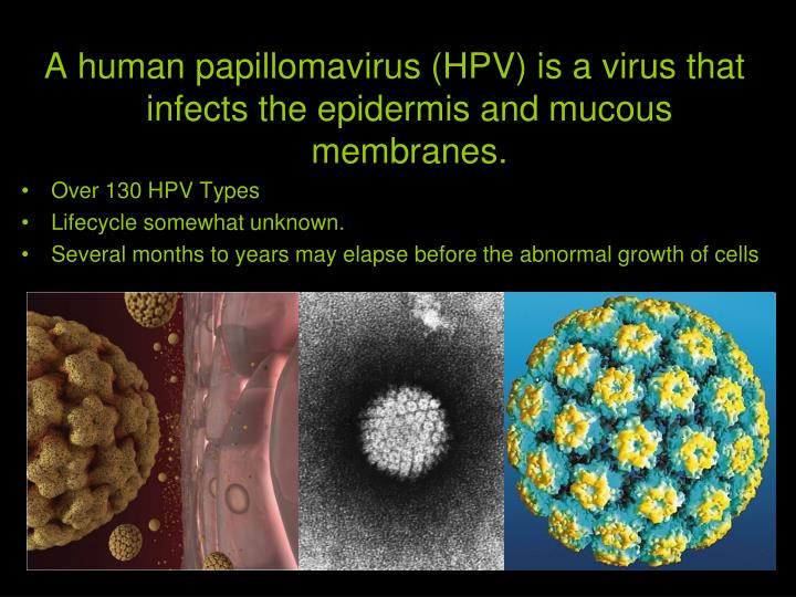 PPT - What is HPV? PowerPoint Presentation - ID:1144545