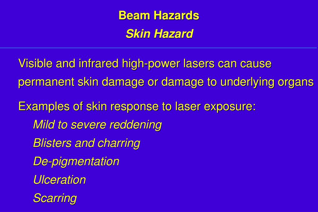 PPT - MGH Wellman Center for Photomedicine Laser Safety PowerPoint ...