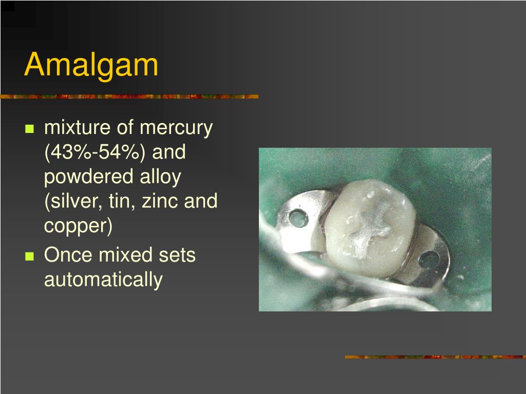 PPT - Dental Restorations in Pediatric Dentisty PowerPoint Presentation ...