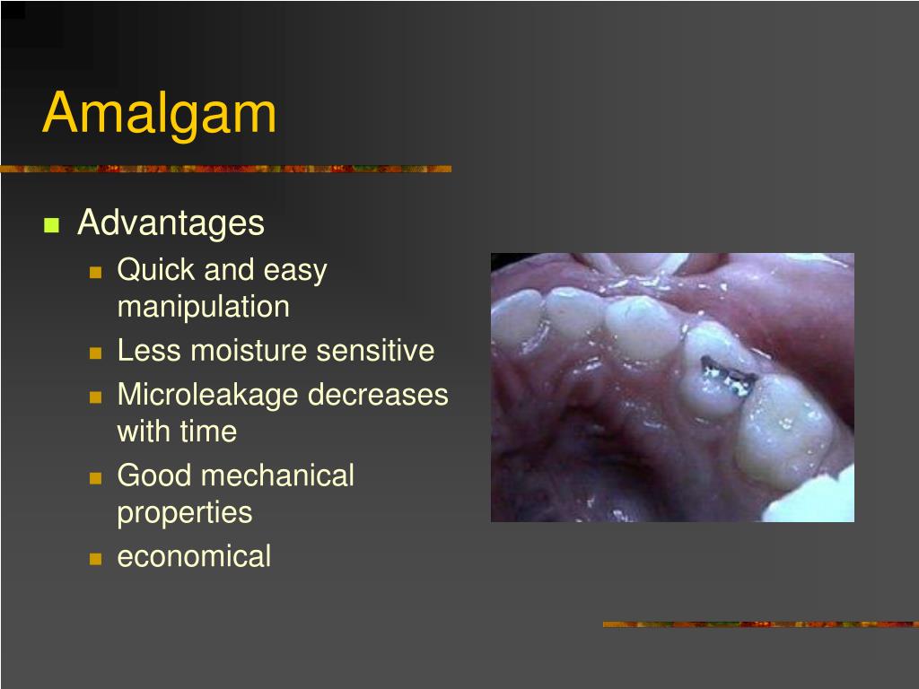 PPT - Dental Restorations in Pediatric Dentisty PowerPoint Presentation ...