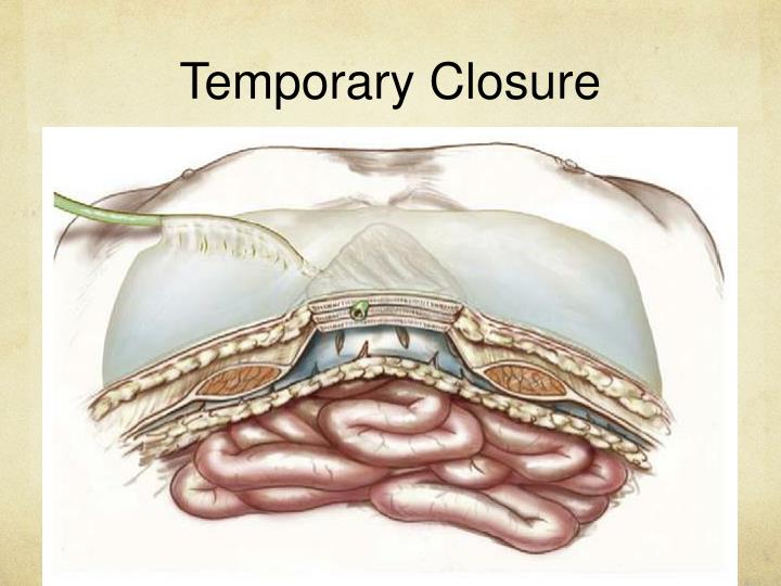 PPT - The Concept of Damage Control Surgery PowerPoint Presentation ...