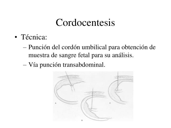 PPT - Cordocentesis o Funiculocentesis PowerPoint Presentation - ID:1150556